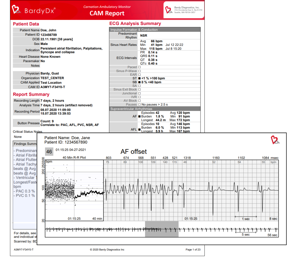Ambulatory ECG Monitoring Solutions Made Simple | Bardy Diagnostics